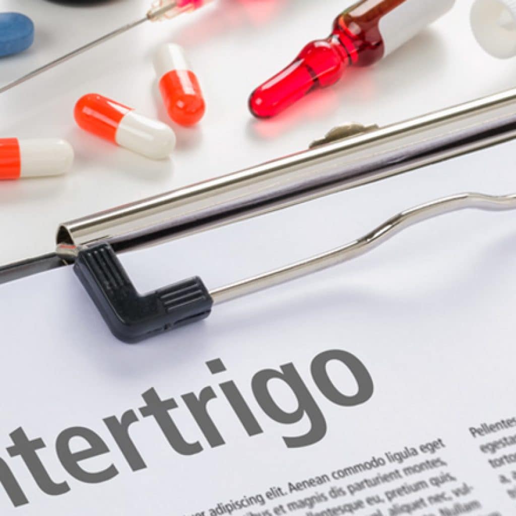 Intertrigo - Conseils santé